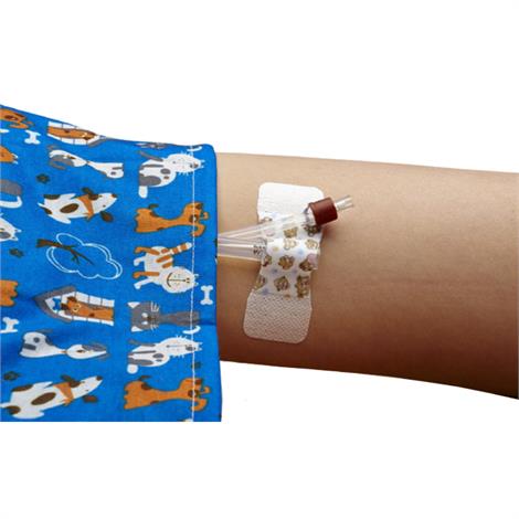 Centurion Pediatric Foley Anchor Securement Device | Catheter ...