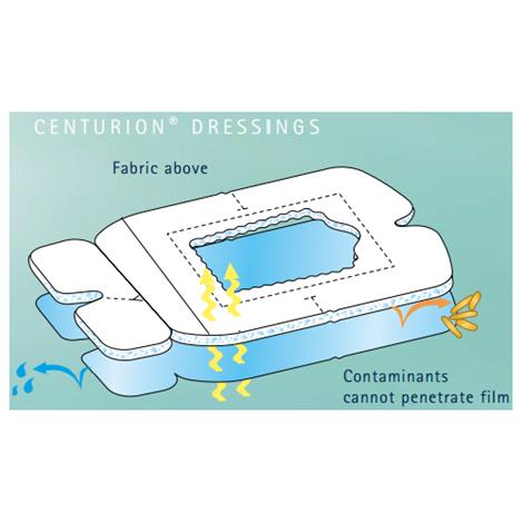 Order Sorbaview 2000 Window Dressing | Catheter/IV Dressings