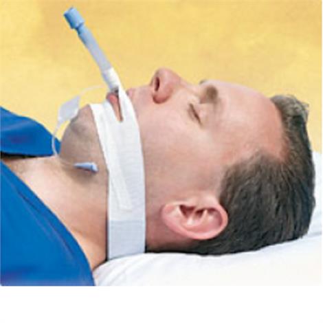 Welcon Trachtape Endotracheal Tube Securing Device | Tracheal Tubes and ...