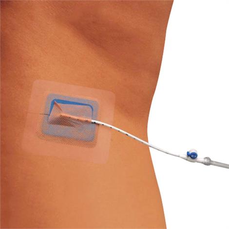 Buy StayFIX Catheter Stabilization Device by Merit Medical